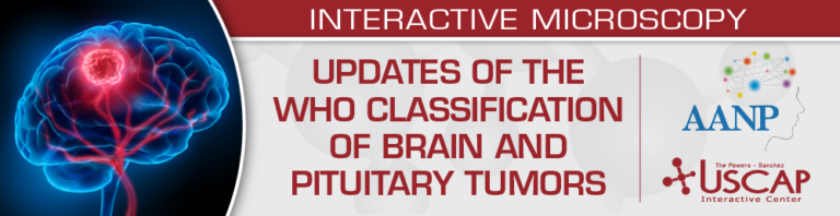 USCAP Updates of the WHO Classification of Brain and Pituitary Tumors ...